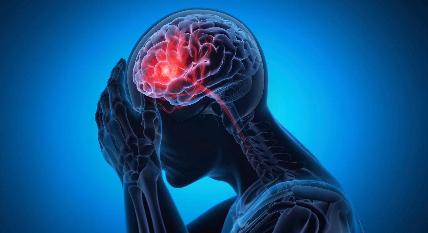 Long-Term Disability After a Stroke | Disability Claim Lawyers